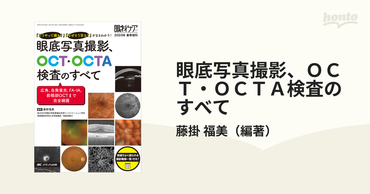 眼底写真撮影、OCT・OCTA検査のすべて 「どうやって撮る？」「なぜそう写る？」がまるわかり！ 広角、自発蛍光、FA・IA、前眼部OCTまで ...